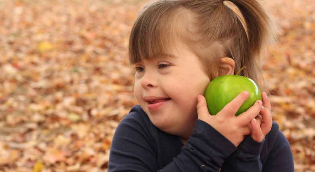 Down Syndrome | MyBioSource Learning Center